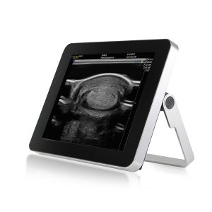 EXAPad Mini | Portable ultrasound just got smaller