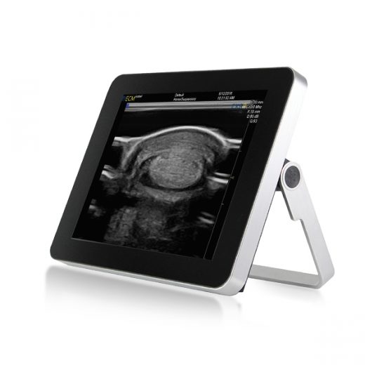 ECM Exago - Ultra Portable Ultrasound Unit | CenQuip