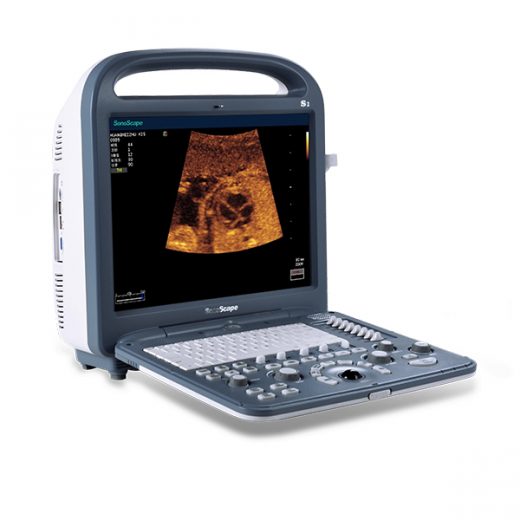 Sonoscape S2 Portable Veterinary Ultrasound - CenQuip